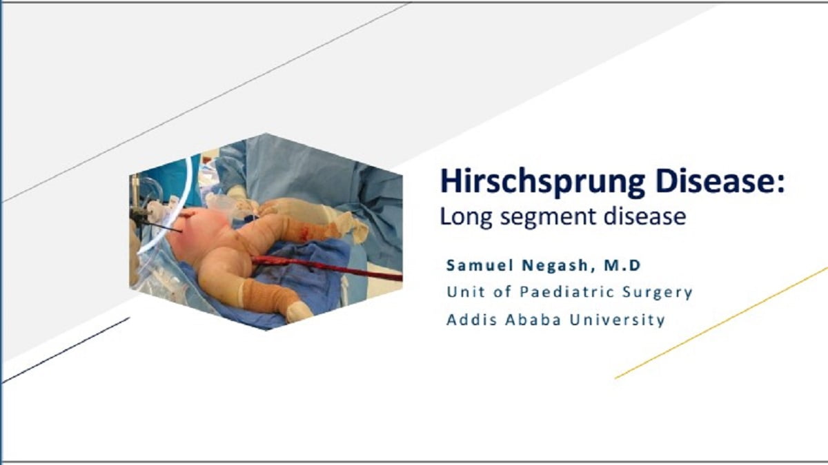 Hirschsprung's Disease (Long segment) - Dr. Tenaboook